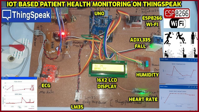 Svsembedded 9491535690 7842358459 Iot Based Patient Health Monitoring On Thingspeak Using